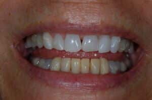 Home - Verber Advanced Dental Studio